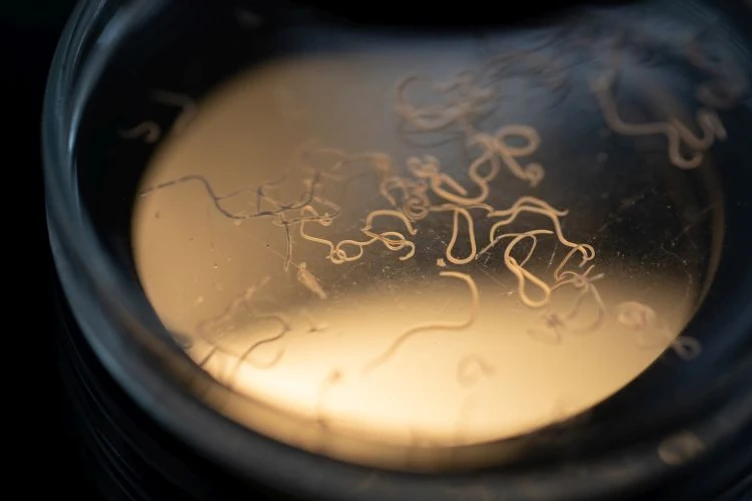 Glistnica — źródła zakażenia, objawy, diagnostyka, leczenie i ...